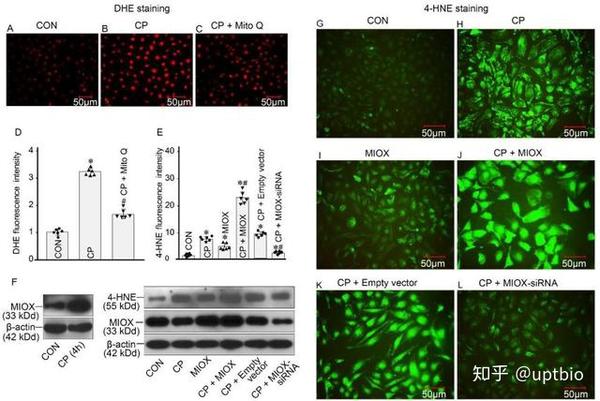 细胞病理性铁死亡？中科院一区带你探索MIOX的妙用 - 知乎