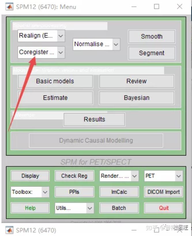 基于SPM的多模态神经影像配准方法 - 知乎