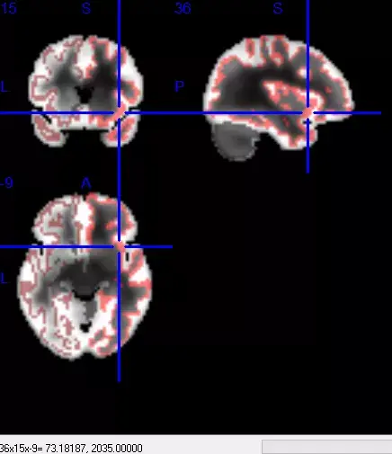 freesurfer学习：ROI Volume to Surface空间变换提取数据 - 知乎