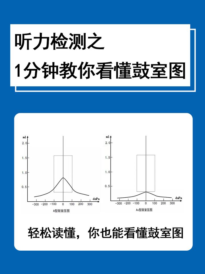 一分钟教你看懂鼓室图 知乎