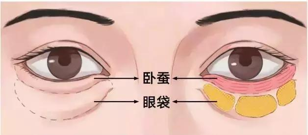 什么是眶隔释放？有什么用？ 知乎