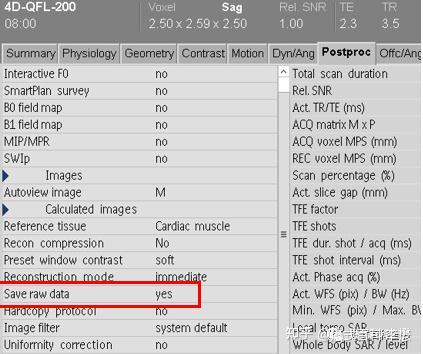 4D-Flow扫描数据采集：序列及参数 - 知乎