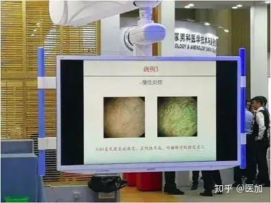 奥林巴斯电子膀胱肾盂镜CYF-VHA,尖端设备 领航医疗创新 - 知乎