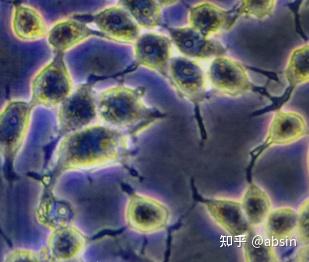 293T细胞培养攻略 - 知乎