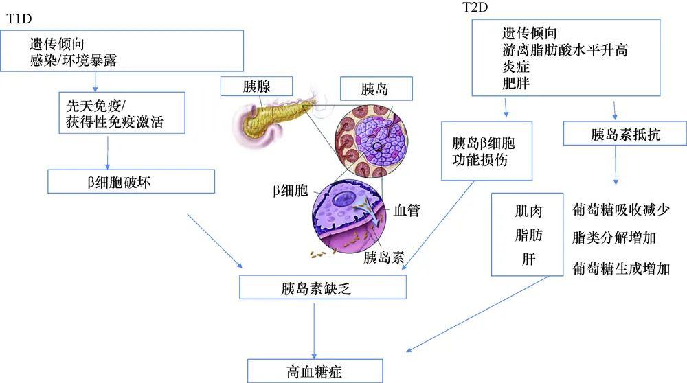 甜骨：糖尿病对骨的影响及糖尿病患者的骨健康管理 - 知乎