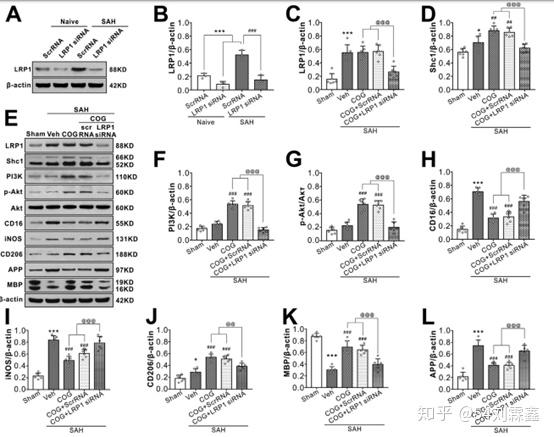 Western blot实验---从入门了解到SCI写作 - 知乎