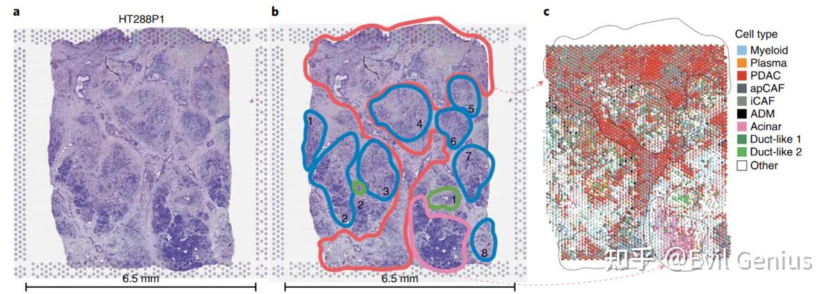 单细胞空间联合分析方法之文献运用篇 - 知乎