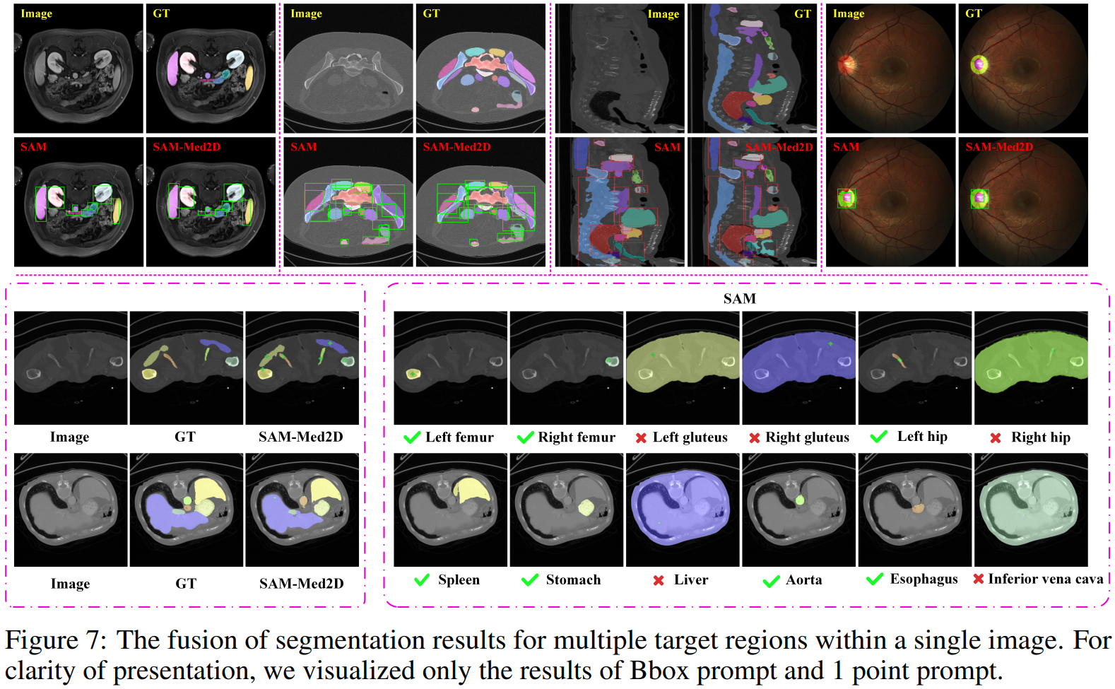 【arXiv 2308】SAM-Med2D（SAM-Med2D） - 知乎