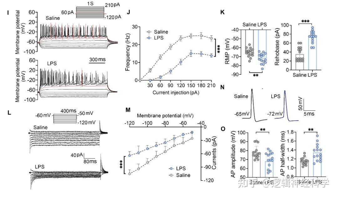 BBI︱四川大学华西医院朱涛/周诚团队揭示腹侧海马齿状回NALCN离子通道调控炎性抑郁的新机制 - 知乎