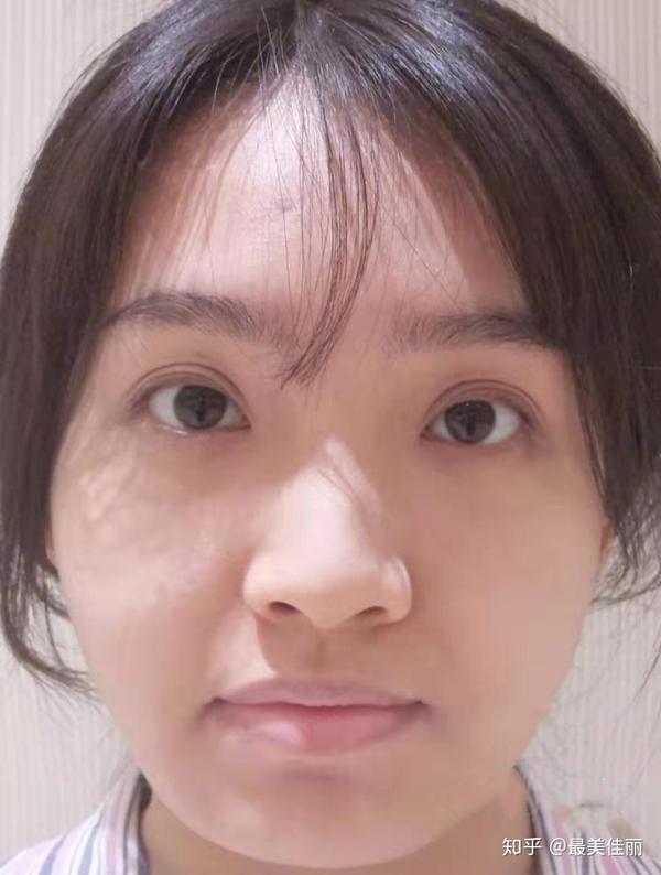 90后老被人认成80后是种什么感受?于是下定决心去做了整形手术 知乎