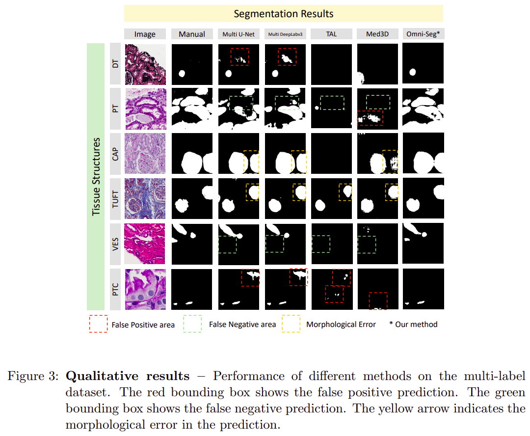 【arXiv:2112】Omni-Seg：使用部分标记数据进行多标签肾脏病理图像分割的单一动态网络 - 知乎