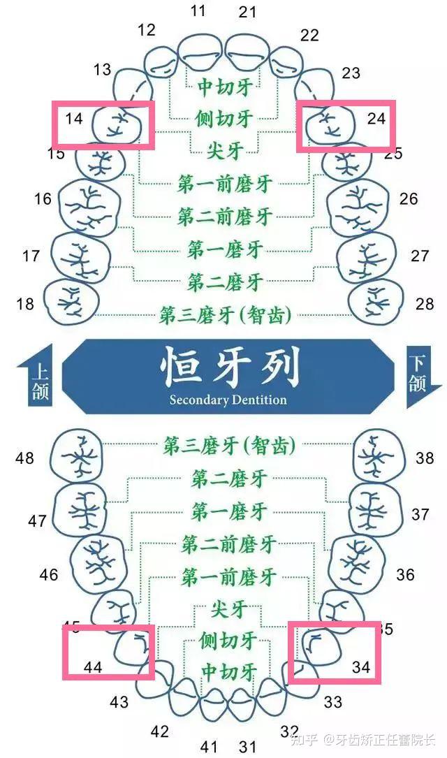 拔牙矫正中为啥老拔四号牙？有科学依据！ - 知乎