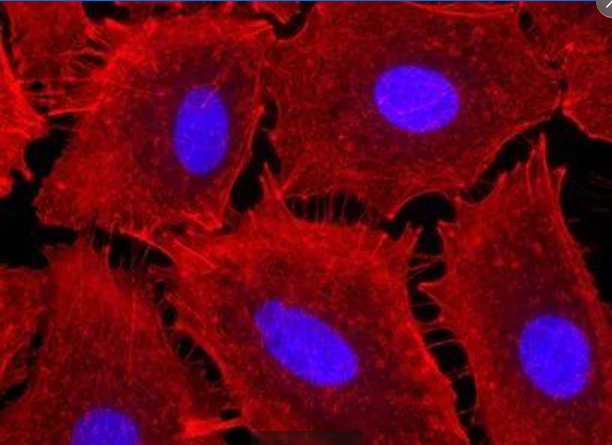 免疫荧光实验方案 |使用 ibidi µ-Slide VI 0.4简便快捷、四步搞定~ - 知乎