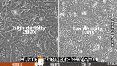 BT-549细胞培养，人乳腺管癌细胞培养攻略 - 知乎