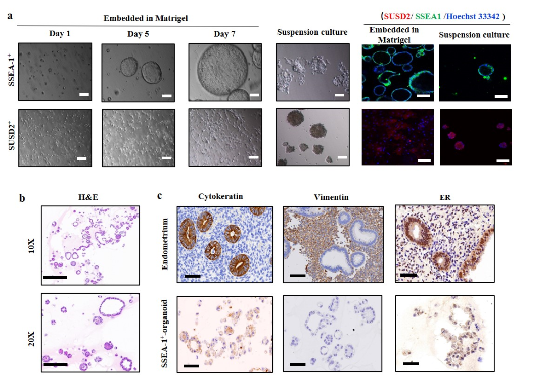 Cell Biosci︱孙晓溪团队/赛立维生物合作建立人子宫内膜上皮干细胞体外培养系统及探索其对IUA的治疗潜能 - 知乎