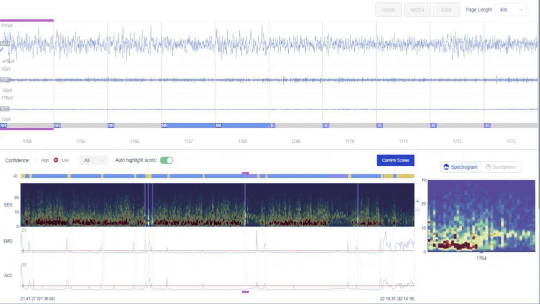 【脑科学】动物睡眠病状中的REM Sleep - 知乎