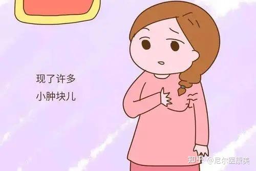 乳腺结节和乳腺增生的早期症状,看看是不是你 知乎