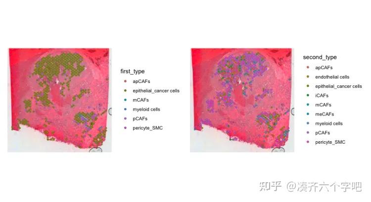 单细胞空间转录组RCTD去卷积分析学习和整理 - 知乎