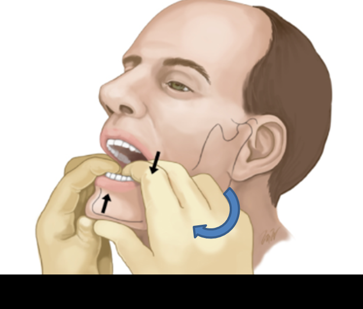 颞下颌关节 - 知乎