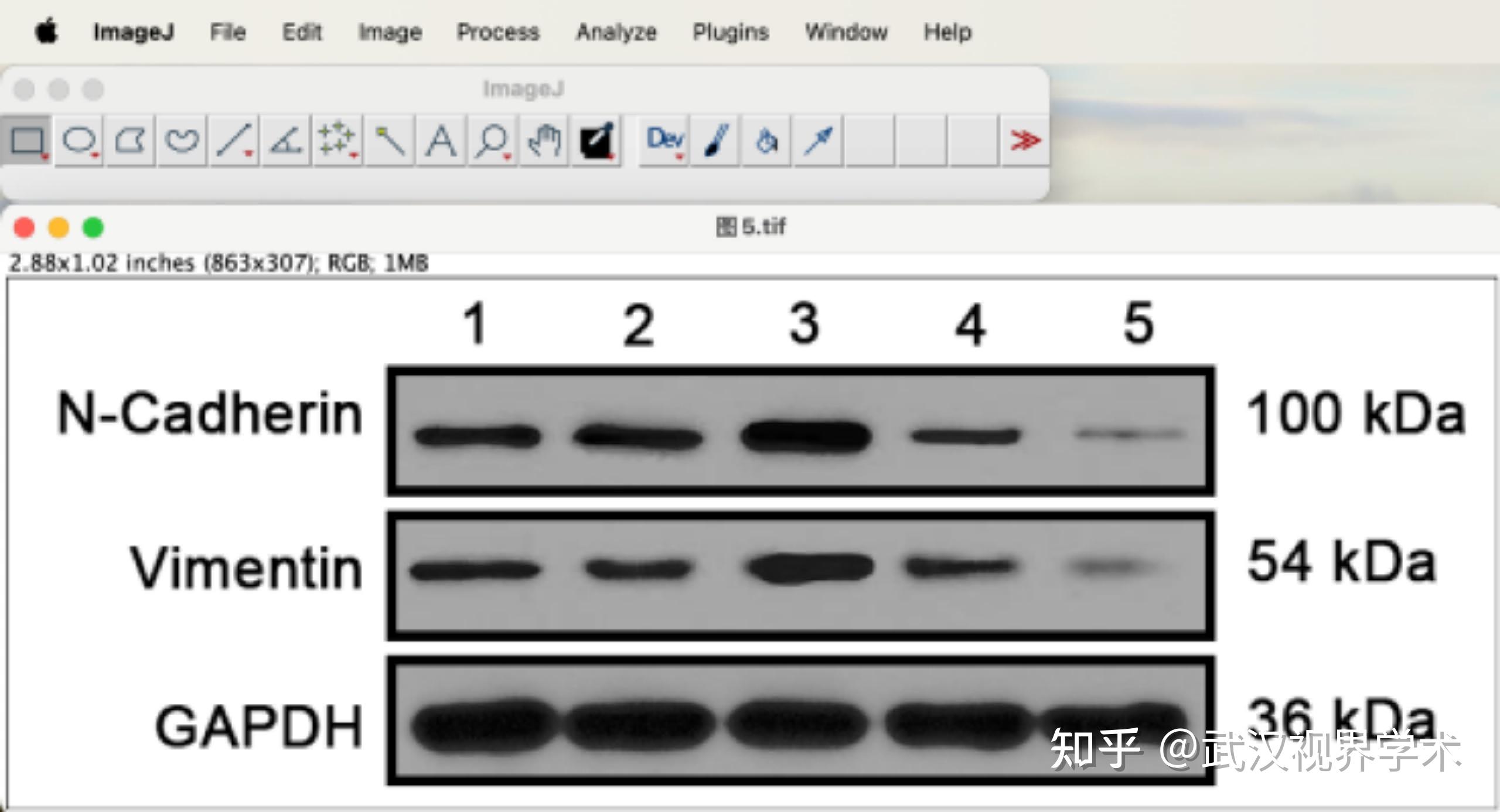 一种用于WB实验结果识别及统计学分析便捷方法 - 知乎