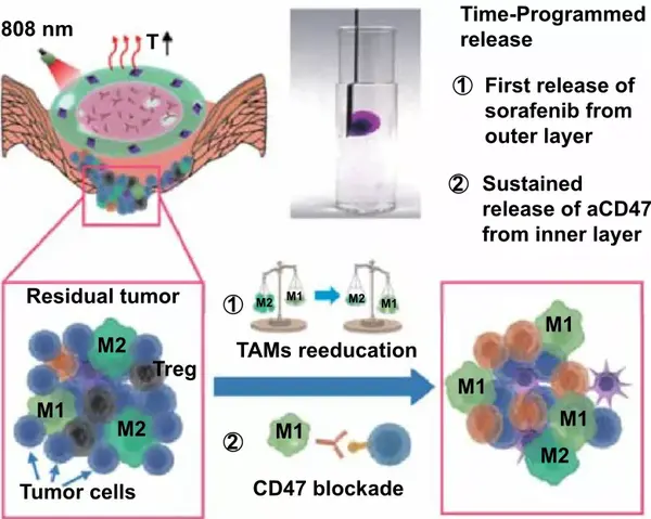 乳腺癌术后治疗：可注射双层凝胶实现索拉非尼和抗CD47抗体的贯序释放 - 知乎