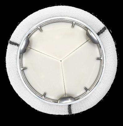 Triflo valve：无需抗凝的机械瓣开启FIM研究 - 知乎