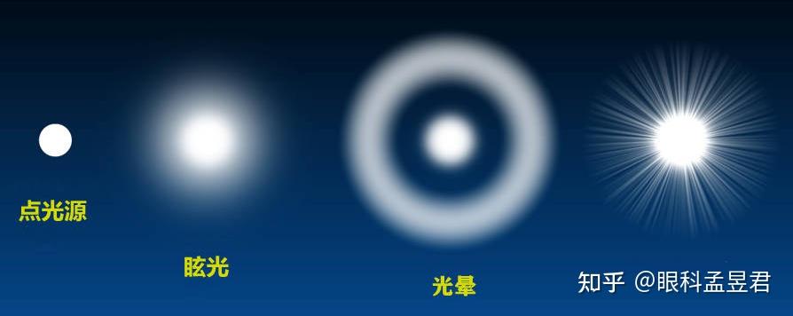 ICL V5究竟好在哪里？ - 知乎