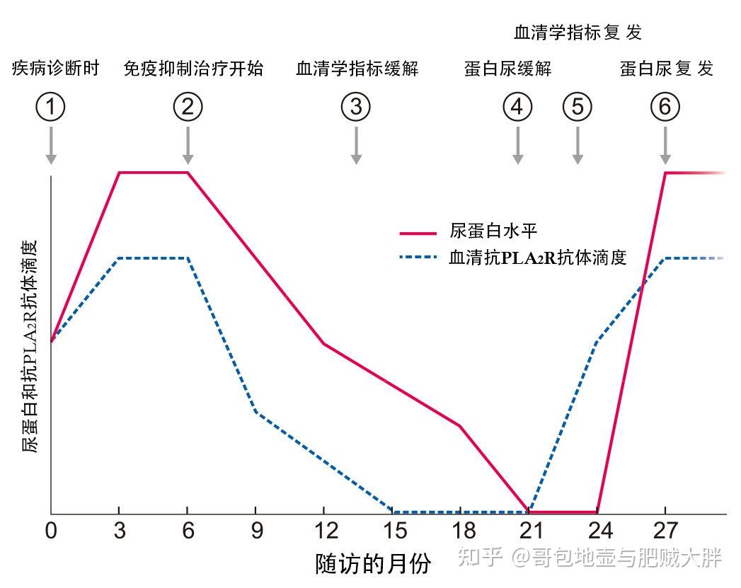 得了膜性肾病为什么医生那么强调PLA2-R？（下） - 知乎