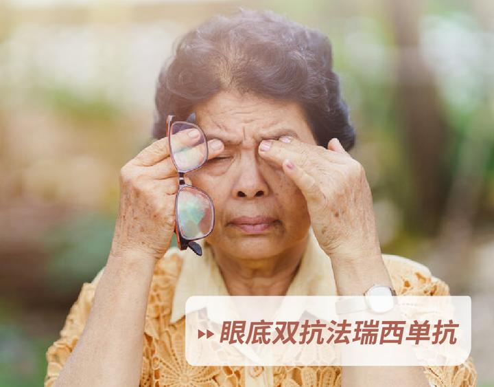 CRVO/HRVO继发黄斑水肿丨双特异性抗体法瑞西单抗在华获批第4项适应症！ - 知乎