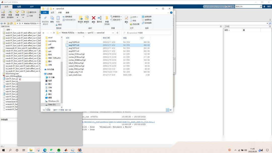 如何用SPM完成fMRI数据的预处理【任务态】 - 知乎