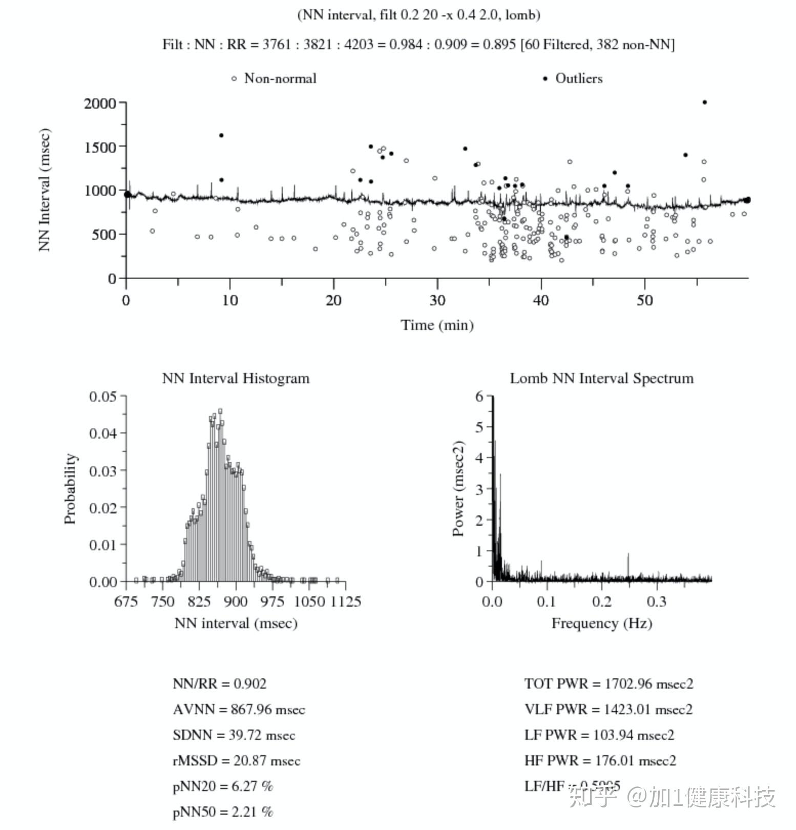 HRV心率变异性分析及指标说明 - 知乎