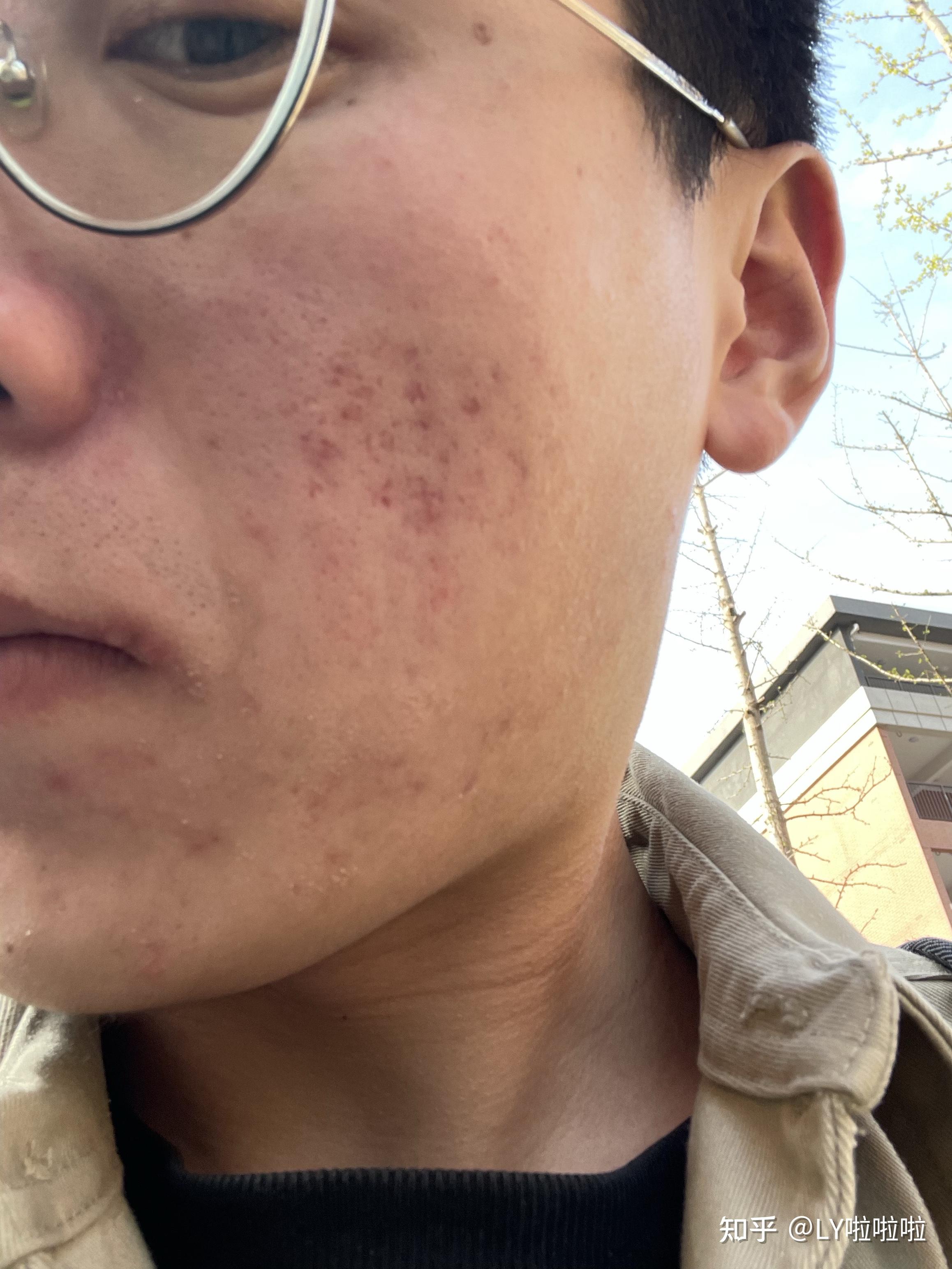 修丽可 色修 本人实际使用效果 知乎