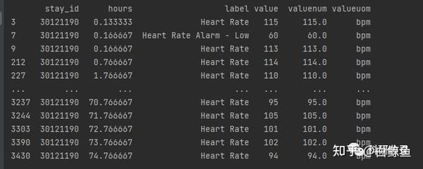 MIMIC-IV数据分析 - 使用Python进行心脏病案例分析(一) - 知乎