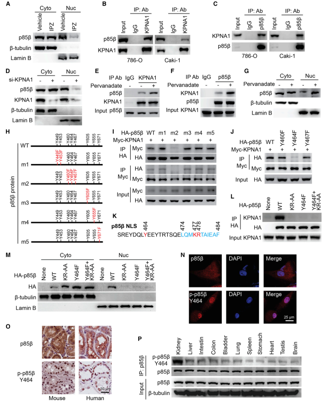 Cell Reports︱郝宇钧团队揭示PI3K调节亚基p85β促进肾透明细胞癌新机制 - 知乎
