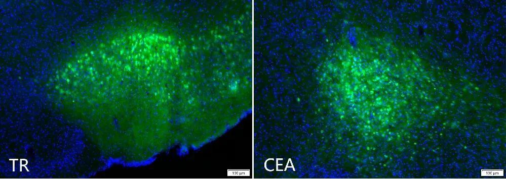 小布tips | 外周PRV示踪-快，准，亮！你想要的都在这！ - 知乎