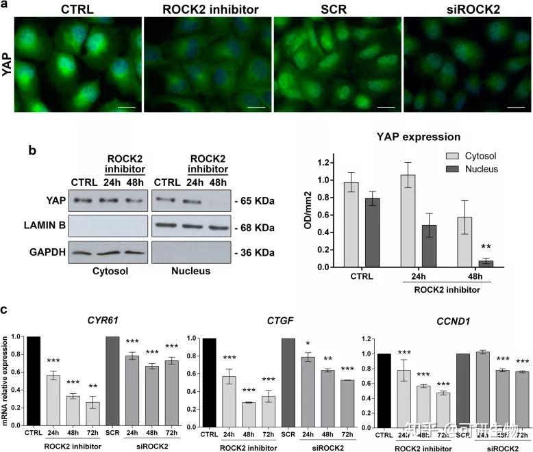 ROCK2缺失可通过调节YAP活性抑制骨肉瘤细胞的生长和转移潜能 - 知乎