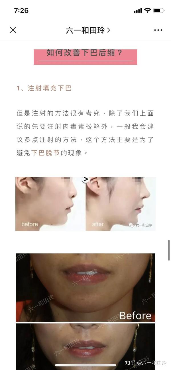 怎样快速摆脱土气感?这个部位是关键。 知乎