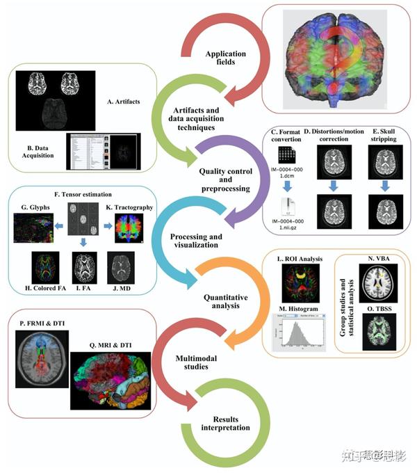思影科技弥散加权成像（DWI/dMRI）数据处理 - 知乎