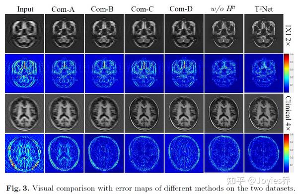 MICCAI2021：Task Transformer network for Joint MRI Reconstruction and ...