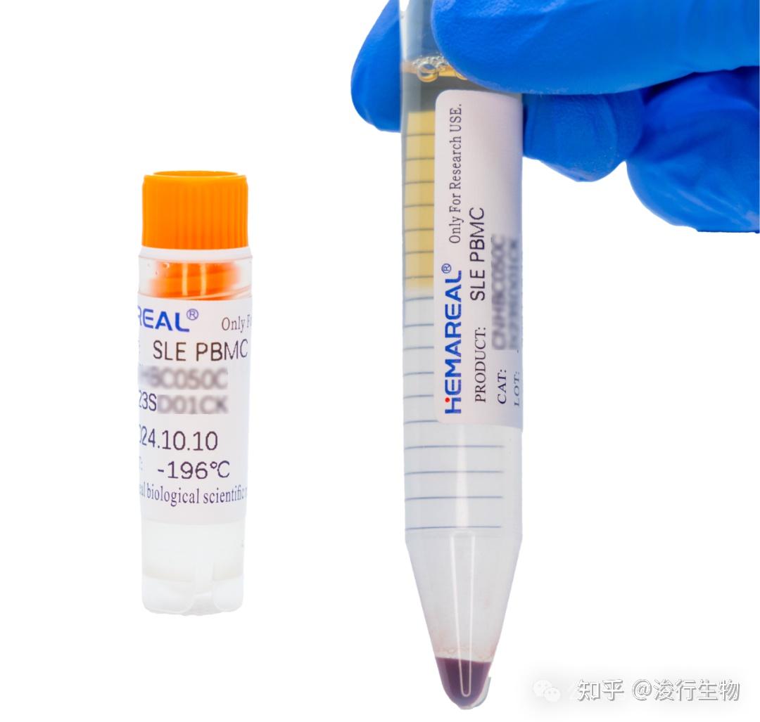免疫研究的工具：外周血单个核细胞（PBMC）在精准医疗中的关键作用 - 知乎