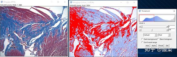 ImageJ高效图片分析技巧 - 知乎