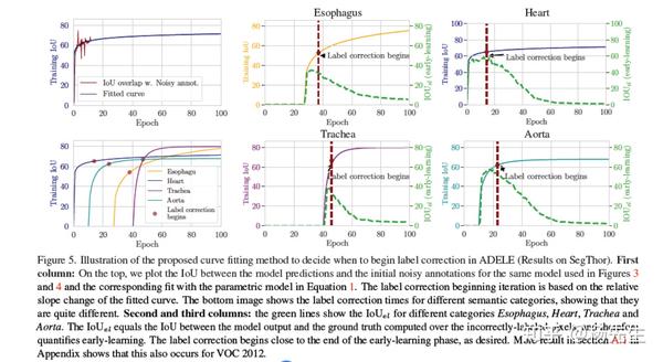 CVPR2022(oral) Adaptive Early-Learning Correction for Segmentation from ...