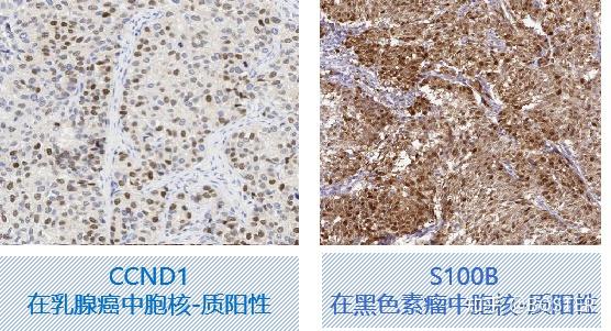 免疫组化（IHC）实验从入门要高阶一篇搞定 - 知乎