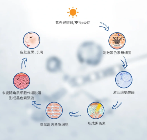 越拖越多?深扒黑色素形成过程~ 知乎