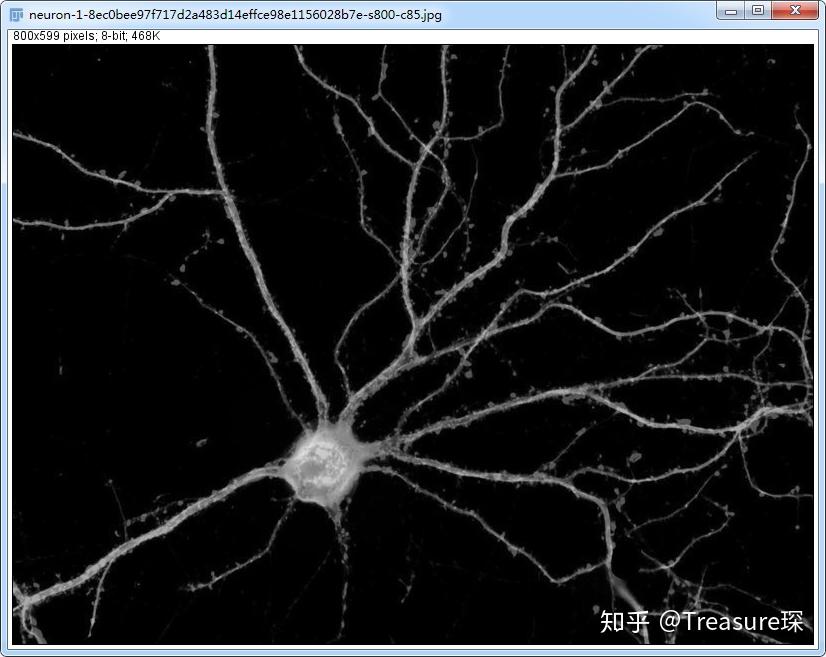 ImageJ实用技巧——Sholl Analysis（二）(插件篇) - 知乎