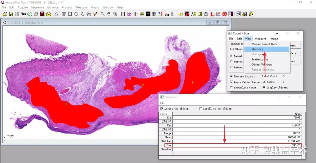 如何采用Image Pro Plus测量病变区域的总面积？ - 知乎