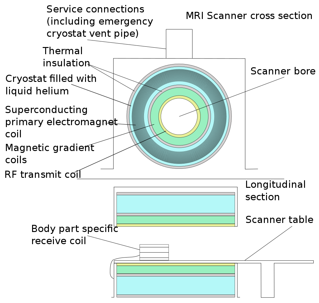 磁共振成像 Magnetic resonance imaging - 知乎