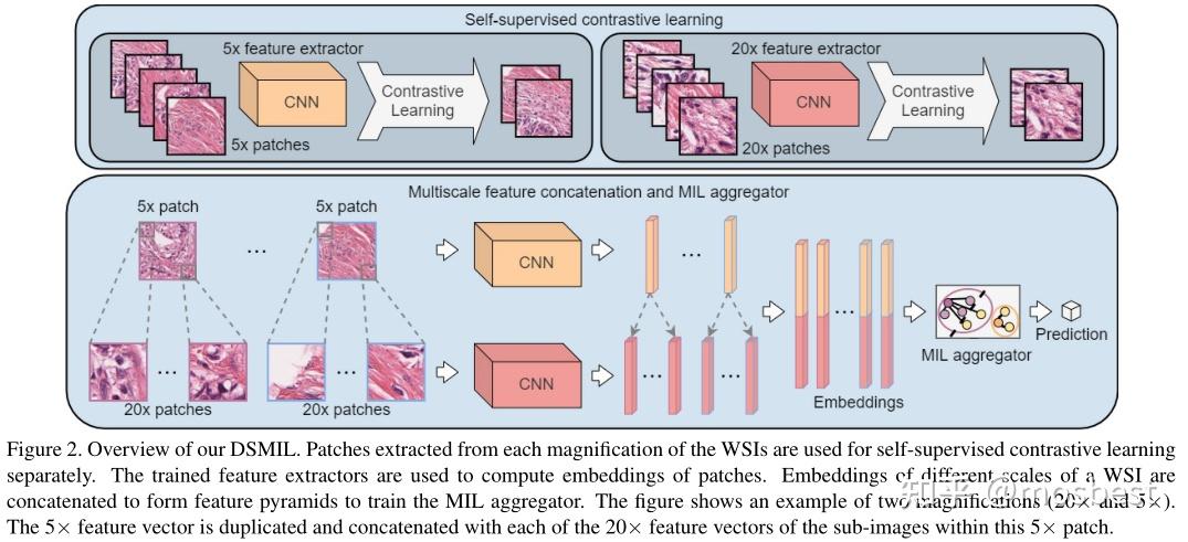 论文：基于自监督对比学习的双流多实例全幻灯片图像分类网络 - 知乎