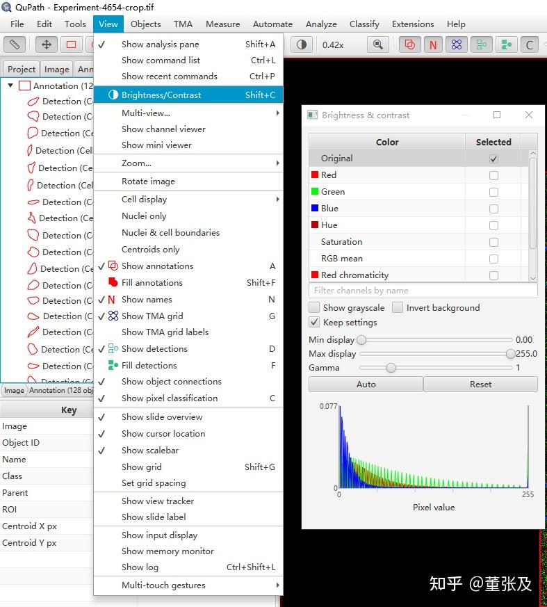 使用QuPath+Cellpose+StarDist分析蛋白入核比率 - 知乎