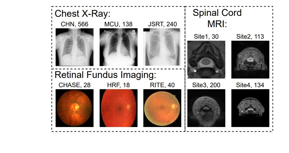 【论文速递240312】Medical Image Segmentation-医学图像分割方向优质的论文及其代码 - 知乎